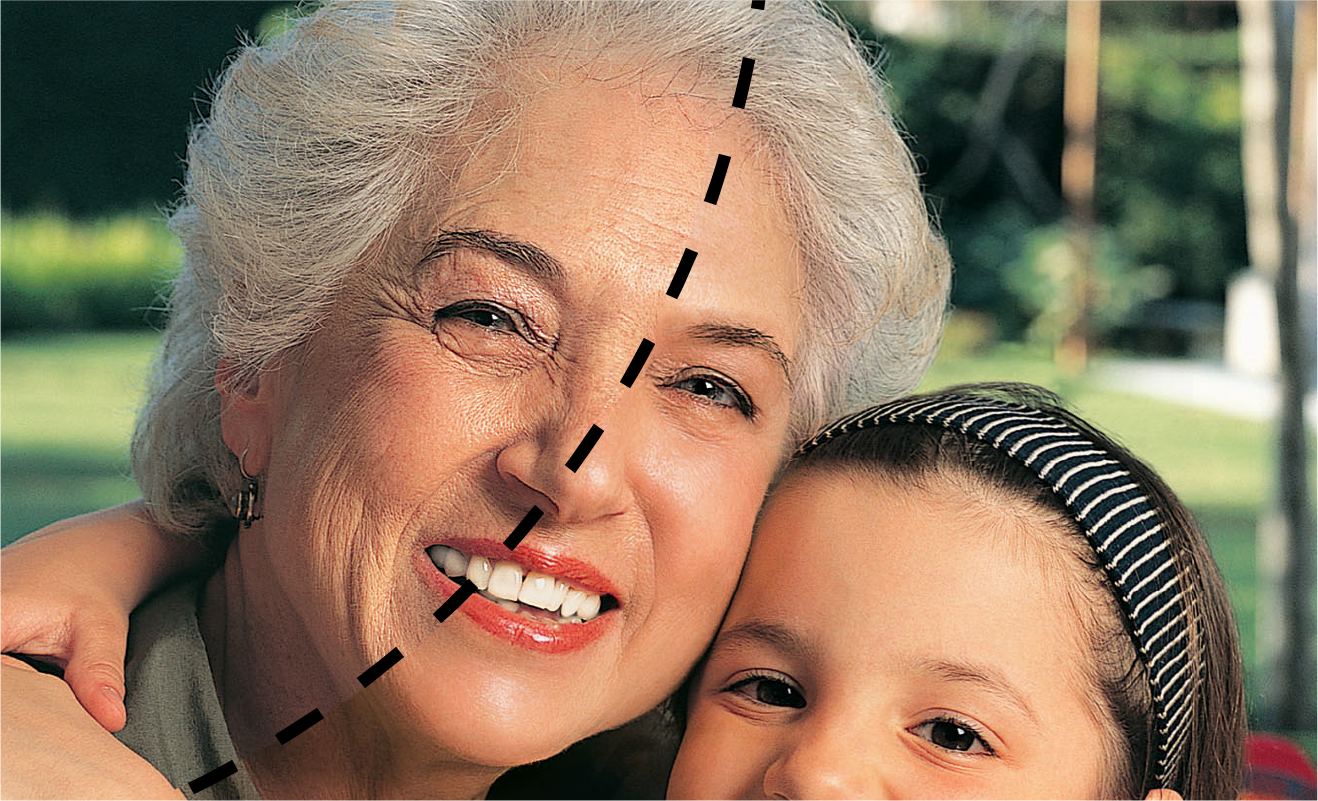 “Placenta Perfect 10” Series 1: Reverse Aging - wikiplacenta